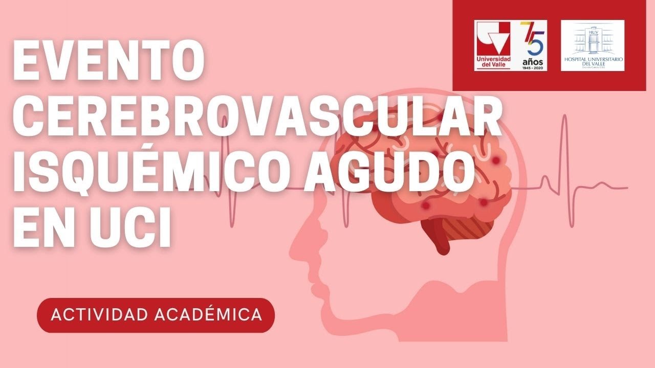 Evento cerebrovascular isquémico agudo en UCI - YouTube
