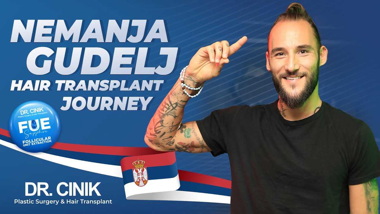 Nemanja Gudelj | FUE | Hair Transplant Journey | Dr. Cinik Hospital ...