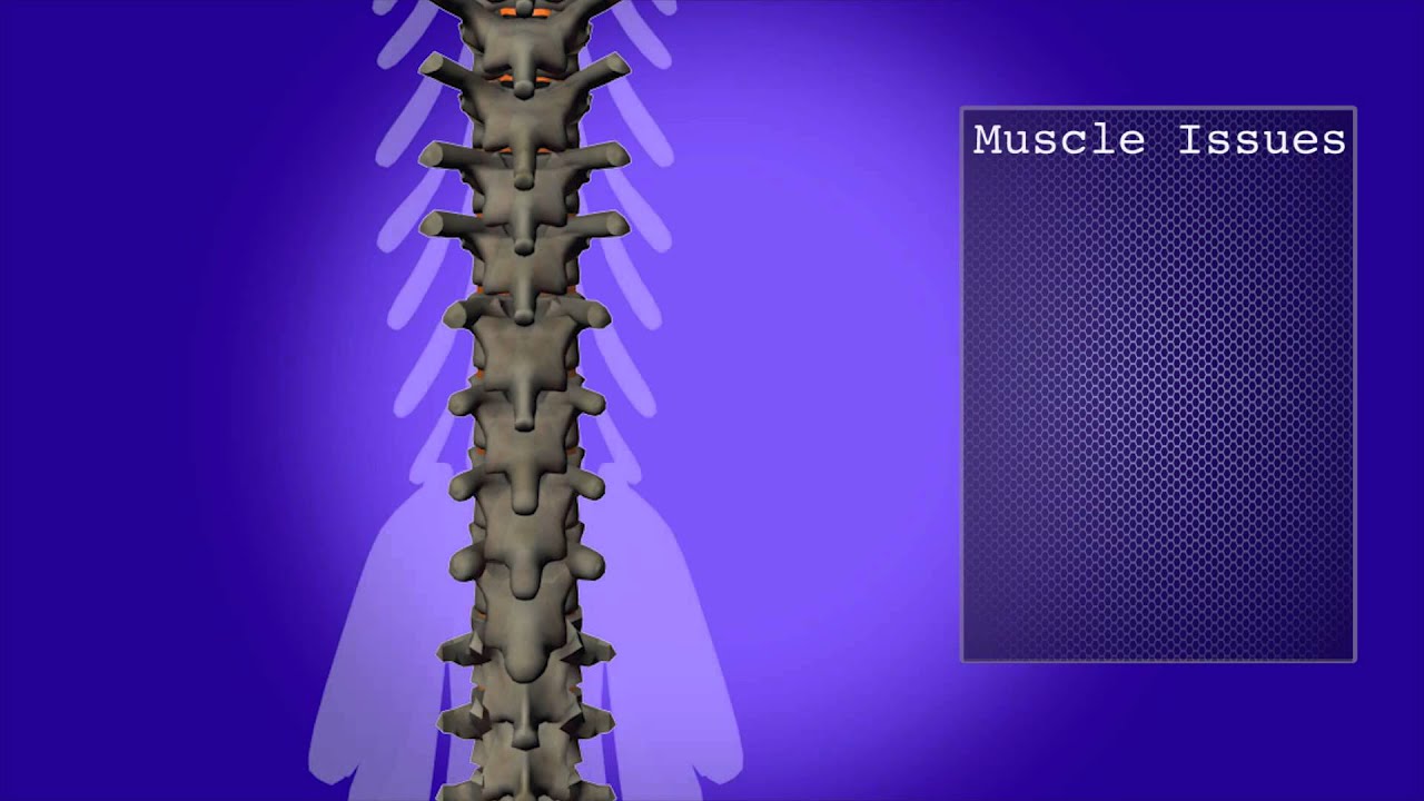 Back to Life Program at Dedham Health - YouTube