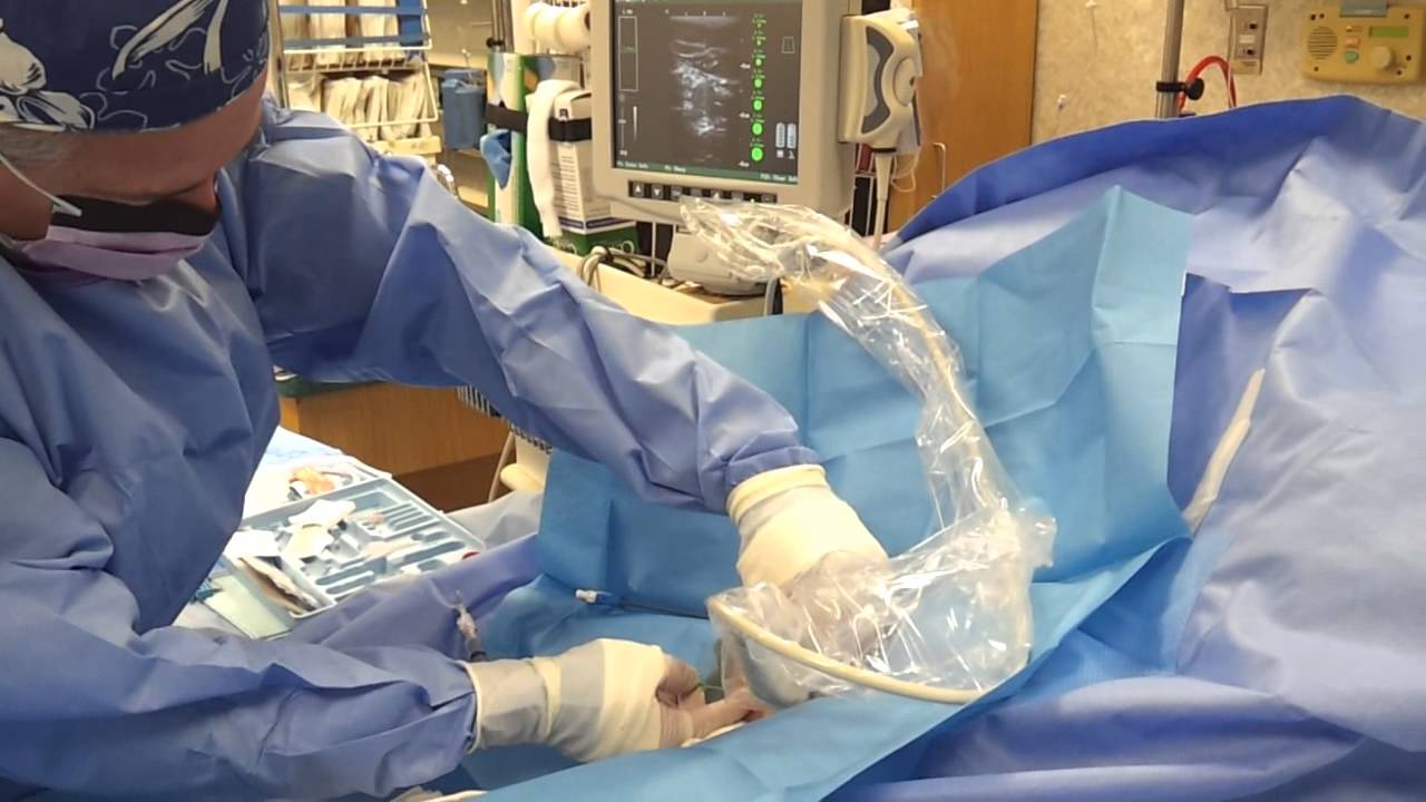 Universal Insertion Kit January 2013 - YouTube