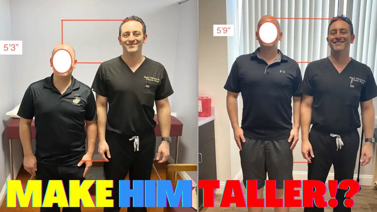 Men Are Getting Height Surgery Now!?! - YouTube