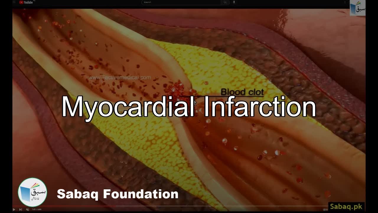 Myocardial Infarction, Biology Lecture | Sabaq.pk - YouTube