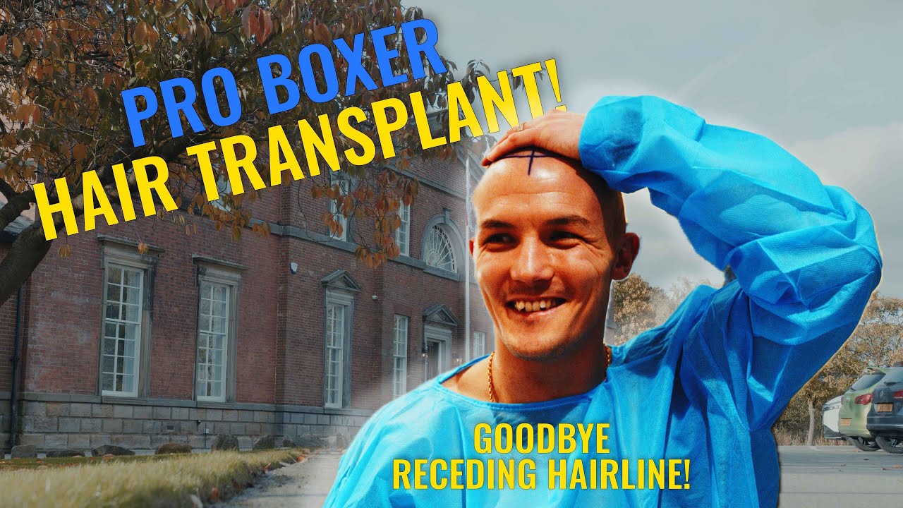 SORTING OUT THE HAIRLINE! PRO BOXER GETS A HAIR TRANSPLANT! - YouTube