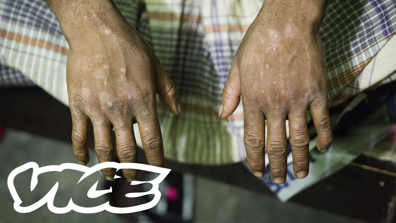 Toxic Tanneries Poisoning Workers in Bangladesh - YouTube