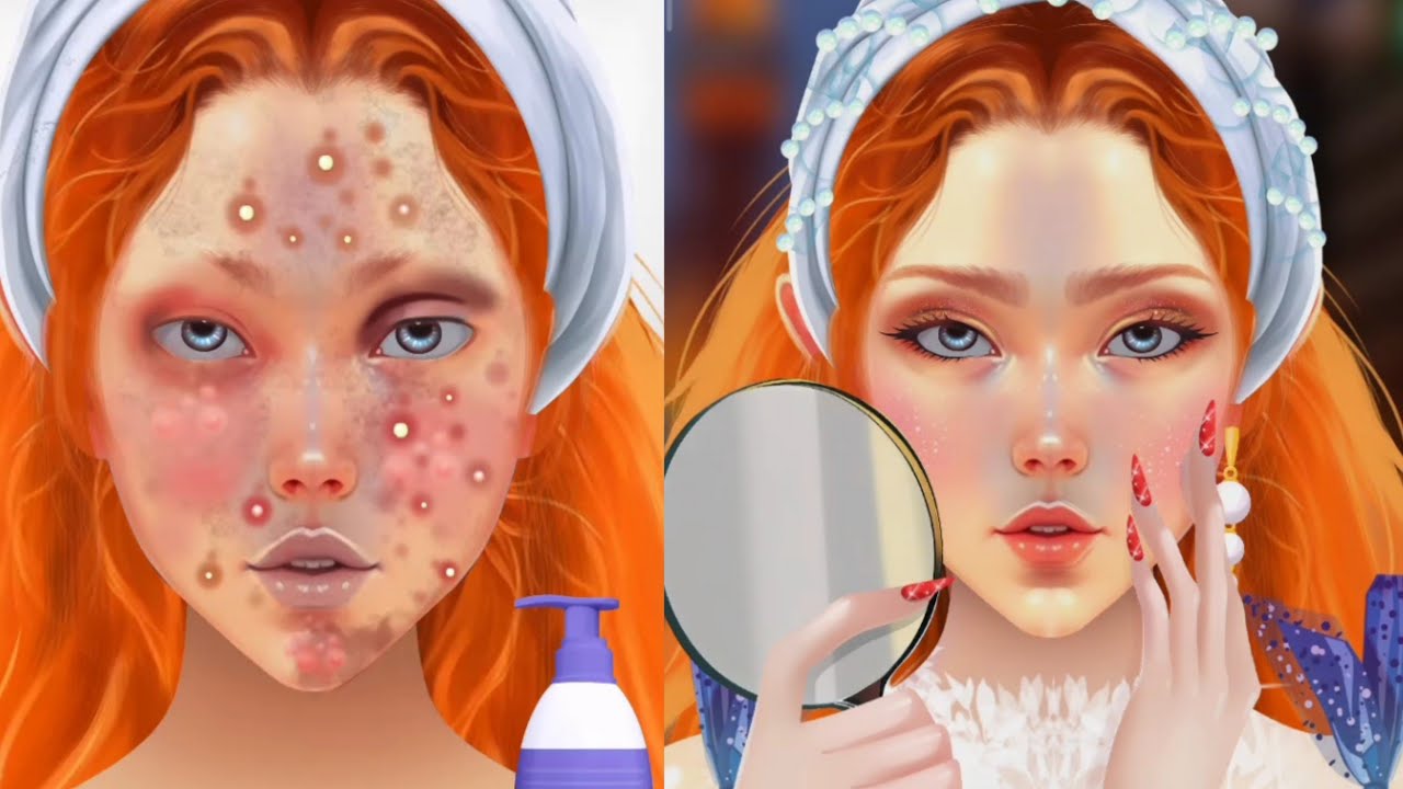 ASMR Chemical peeling skin on the face | Dermaplaning skincare ...