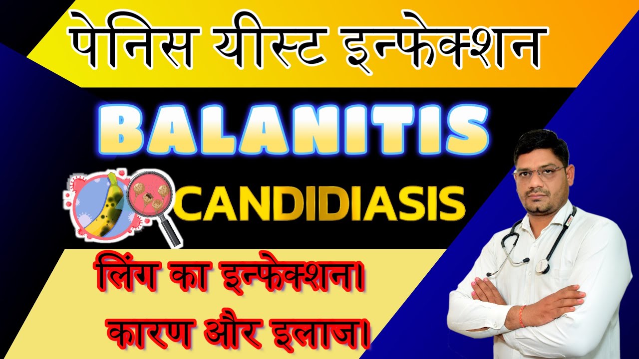 Balanitis homeopathic treatment | Penile yeast infection | How to cure ...