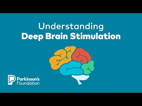 Understanding Deep Brain Stimulation (DBS) | Parkinson's Foundation