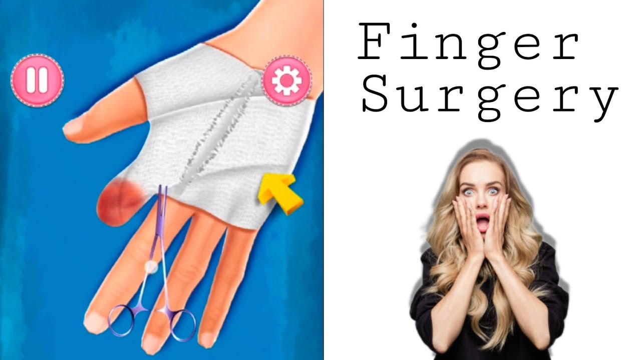 Cut Finger Attached Surgery Video | Animation Video | Surgery Oparation ...