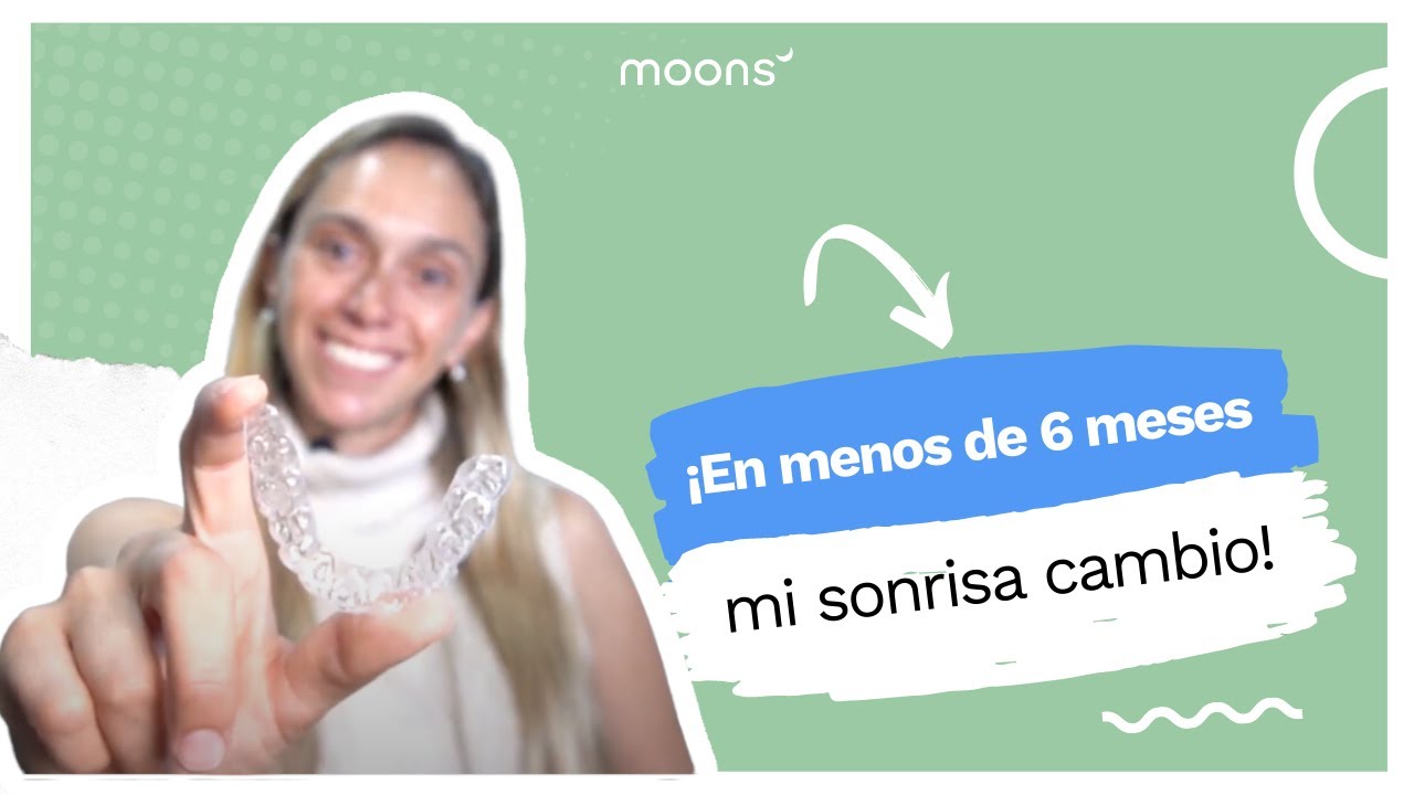 Opiniones Moons | Jimena recomienda usar alineadores invisibles Moons ...