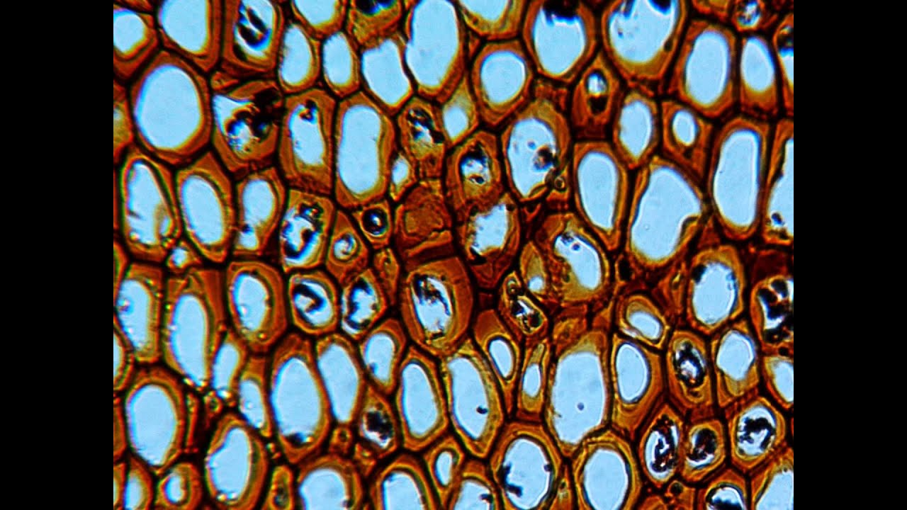 Plasmodesmos ( Plasmodesma ) - Mikroskop HD+ Video Deutsch - YouTube