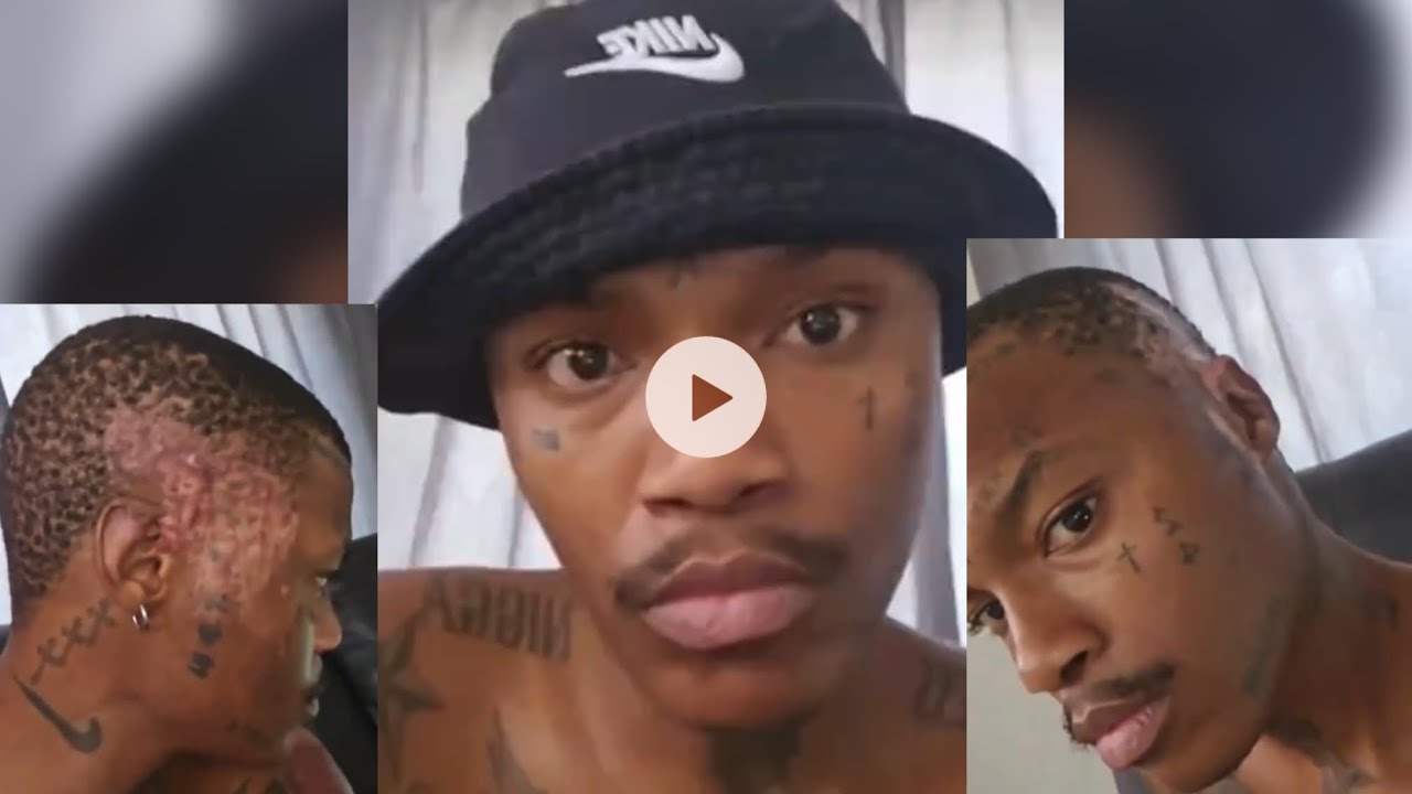 Shebe Shxt shows hidden scars he got during fatal accident which ...