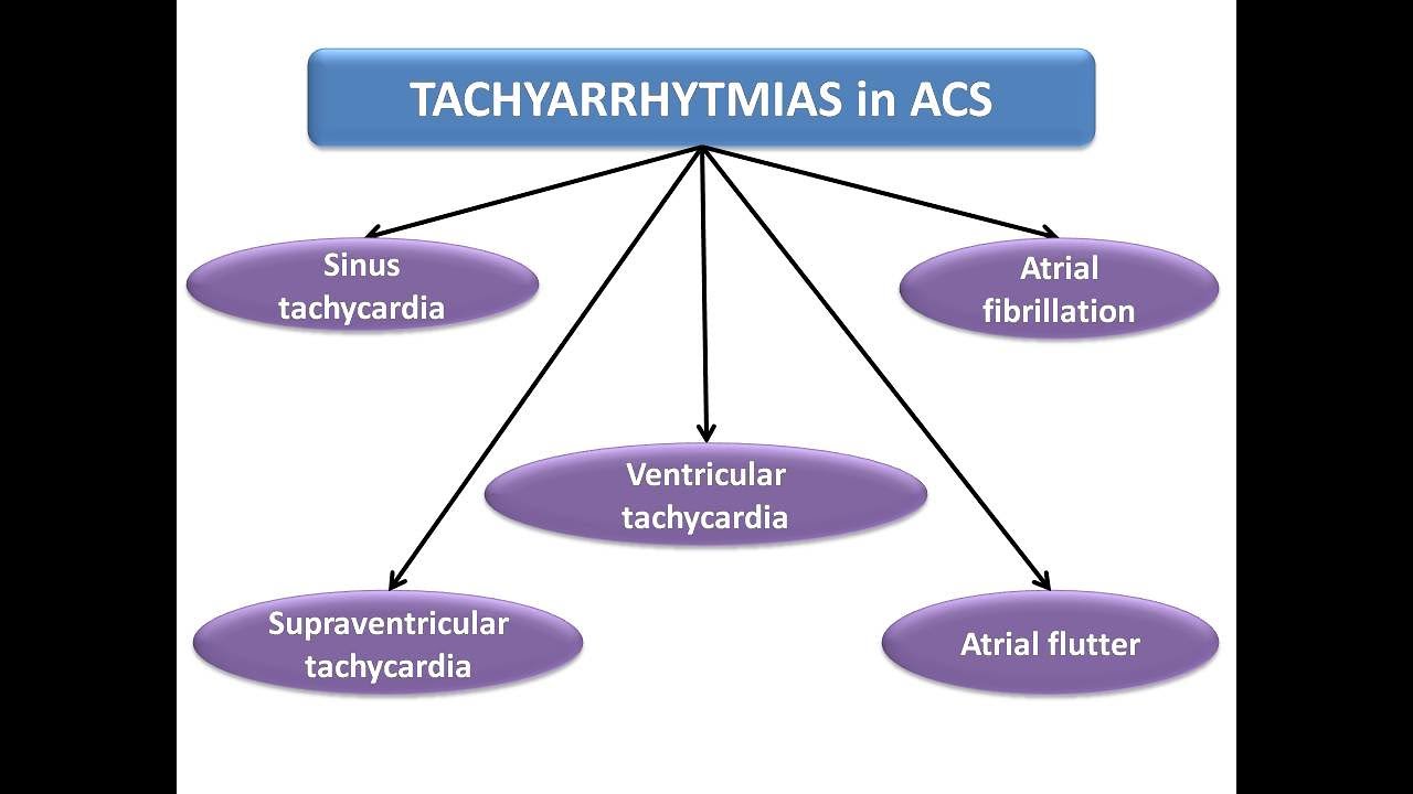 ECG course: Tachyarrhythmias with ACS, Dr. Sherif Altoukhy - YouTube