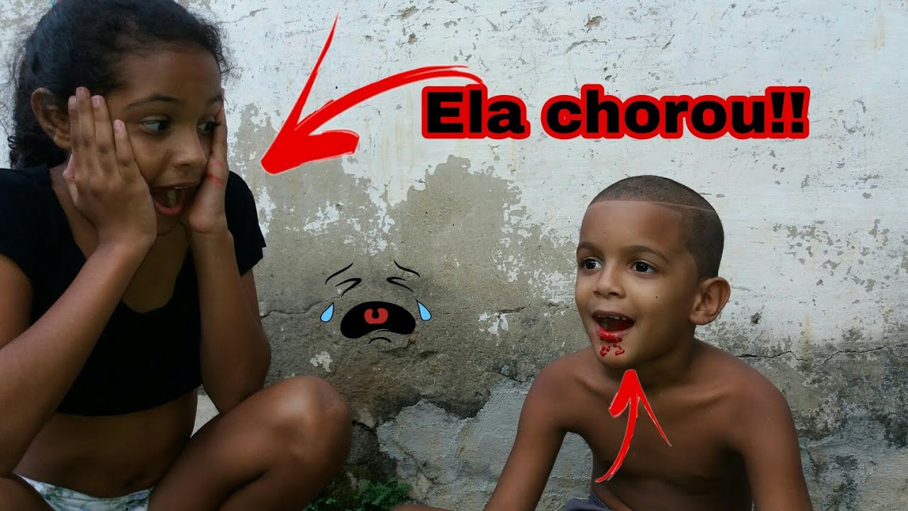 Trollei Minha Irmã Fingindo Que Me Machuquei E Ela Chorou Youtube