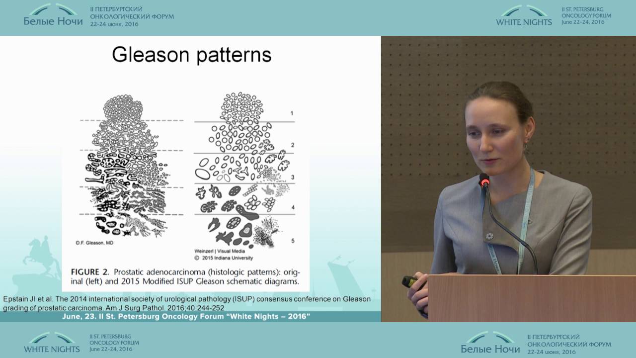 New Prostate Acinar Adenocarcinoma Classification: Gleason Grading ...