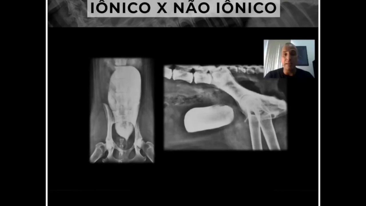 Tipos de contraste iodado - YouTube
