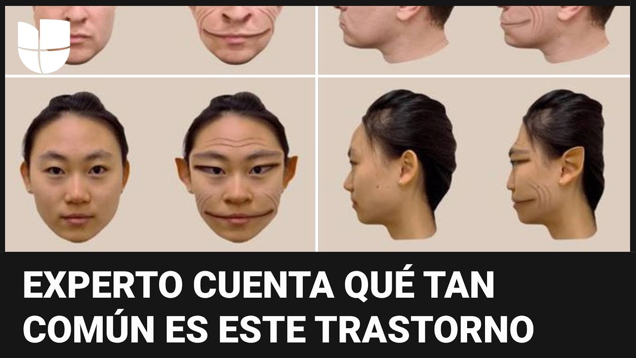 Esta rara enfermedad hace ver las caras de las personas como demonios ...