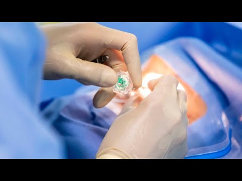 Inyecciones intraoculares | Resolvemos vuestras dudas - YouTube