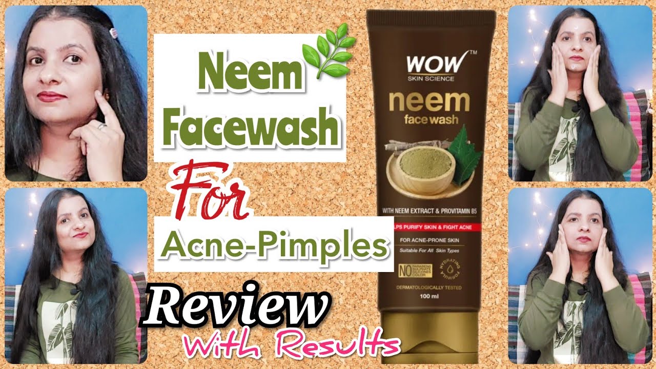 WOW Neem Face Wash | Anti Acne Neem Facewash Review with Results # ...
