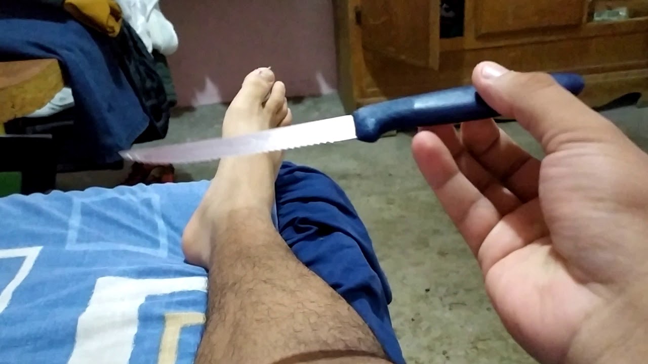 Cómo amputar un pie - YouTube