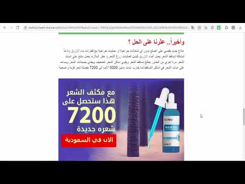 Biohira - Kuwait - Hairloss
