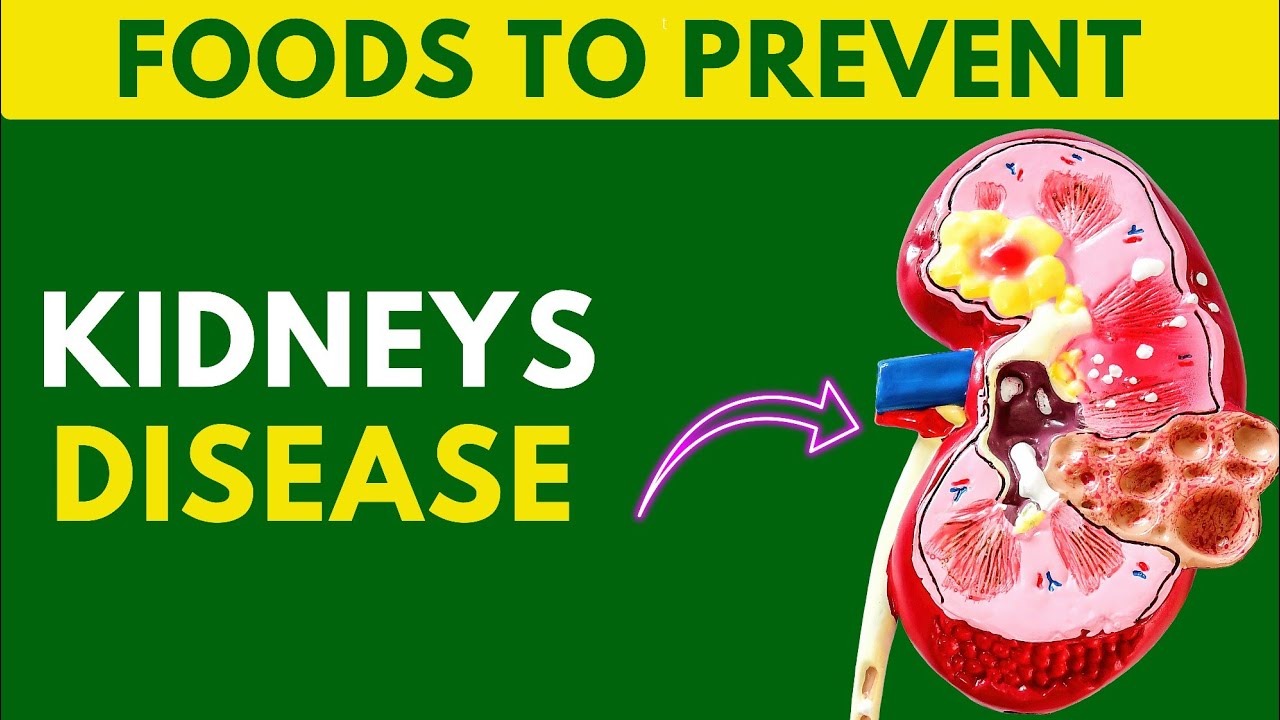 The 5 Powerful Foods That Prevent Kidney Disease - YouTube