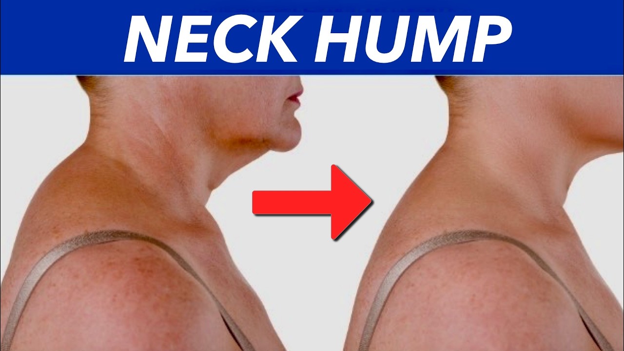 HOW TO FIX A NECK HUMP AT HOME AT THE WALL - YouTube