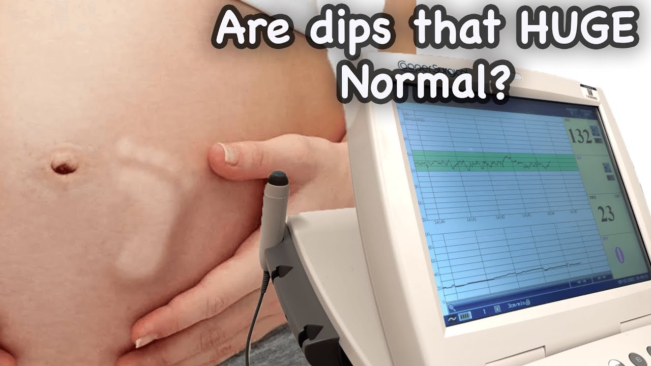 My baby is kicking like crazy so I got an NST test in pregnancy ! - YouTube