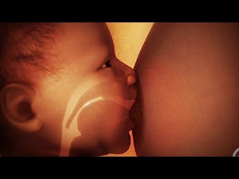 What To Do About Nipple Pain (Arabic) - Breastfeeding Series