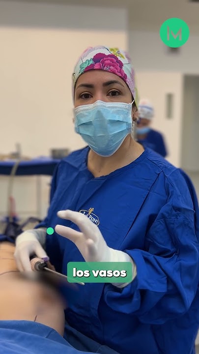 😮 La REVOLUCIÓN QUIRÚRGICA para una MEJOR CIRUGÍA! 🚀 descubre el increíble poder del VASER # ...