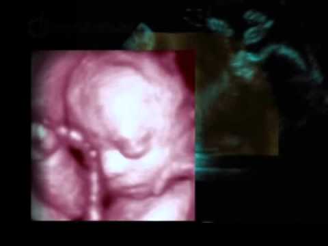 Ultrasound images of baby at 27 weeks - YouTube