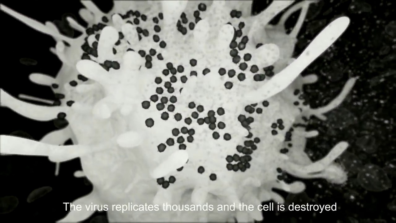 Aids Virus Under A Microscope