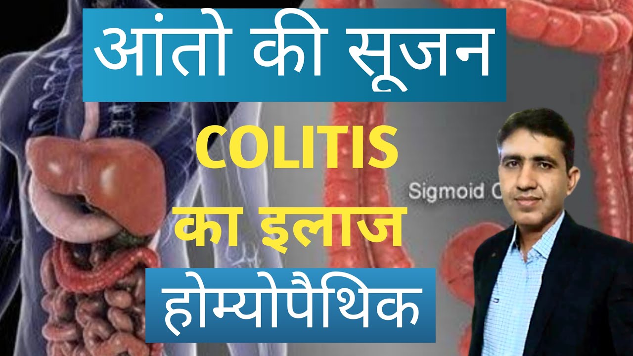 Colitis Treatment in Homeopathy | आंतो की सुजन का इलाज होम्योपैथिक ...