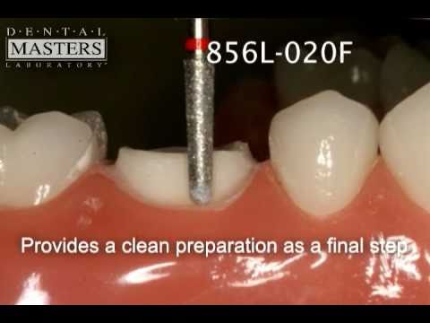 Perfect Prep Bur Kit for e.max CAD by Dental Masters Laboratory - YouTube