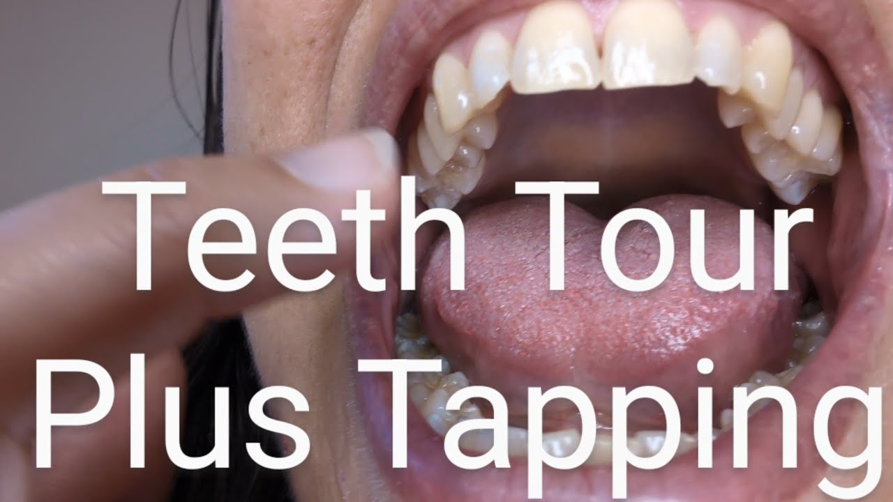 LONGER Teeth Tour Tooth Tapping SUBSCRIBER REQUEST - YouTube