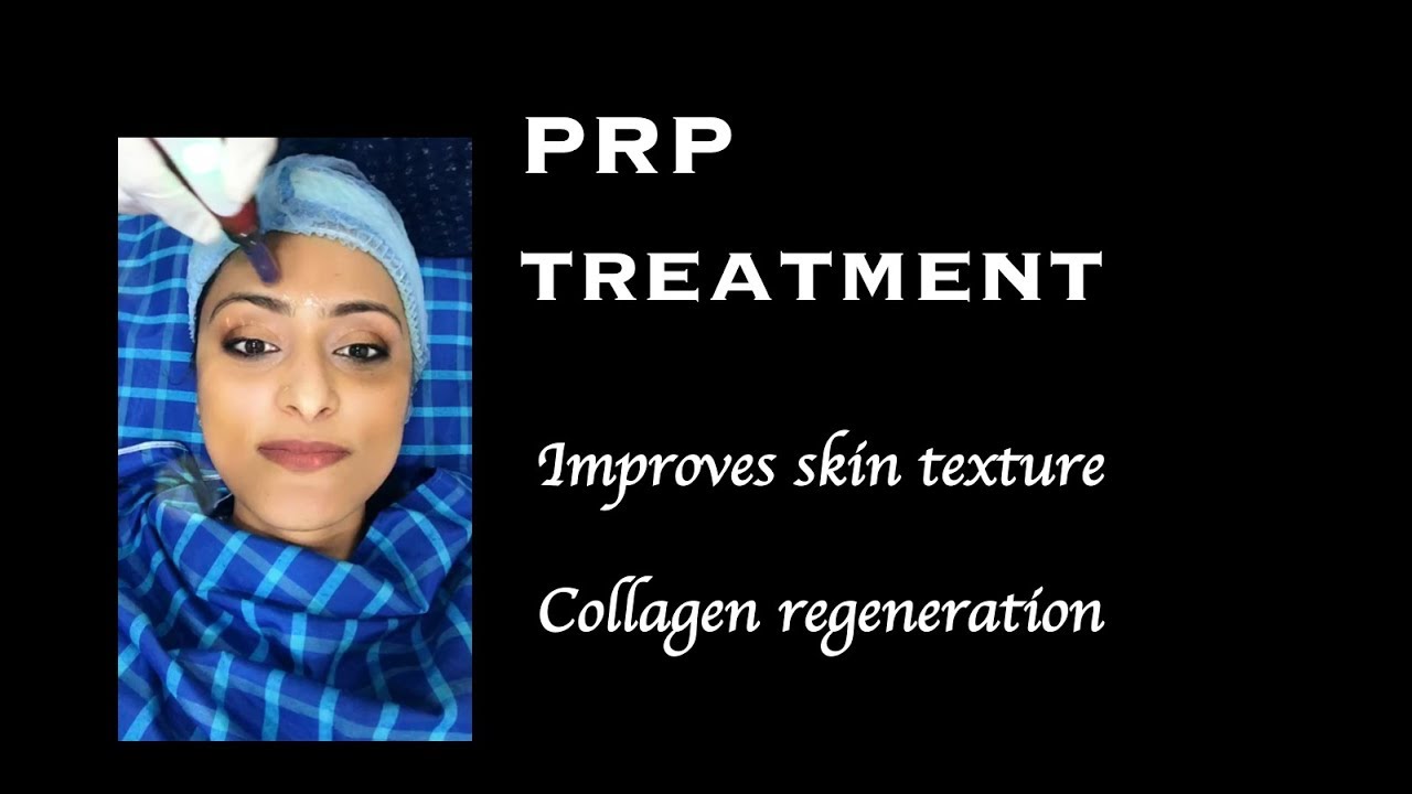 Dermatologist undergoes face PRP | platelet rich plasma therapy - YouTube