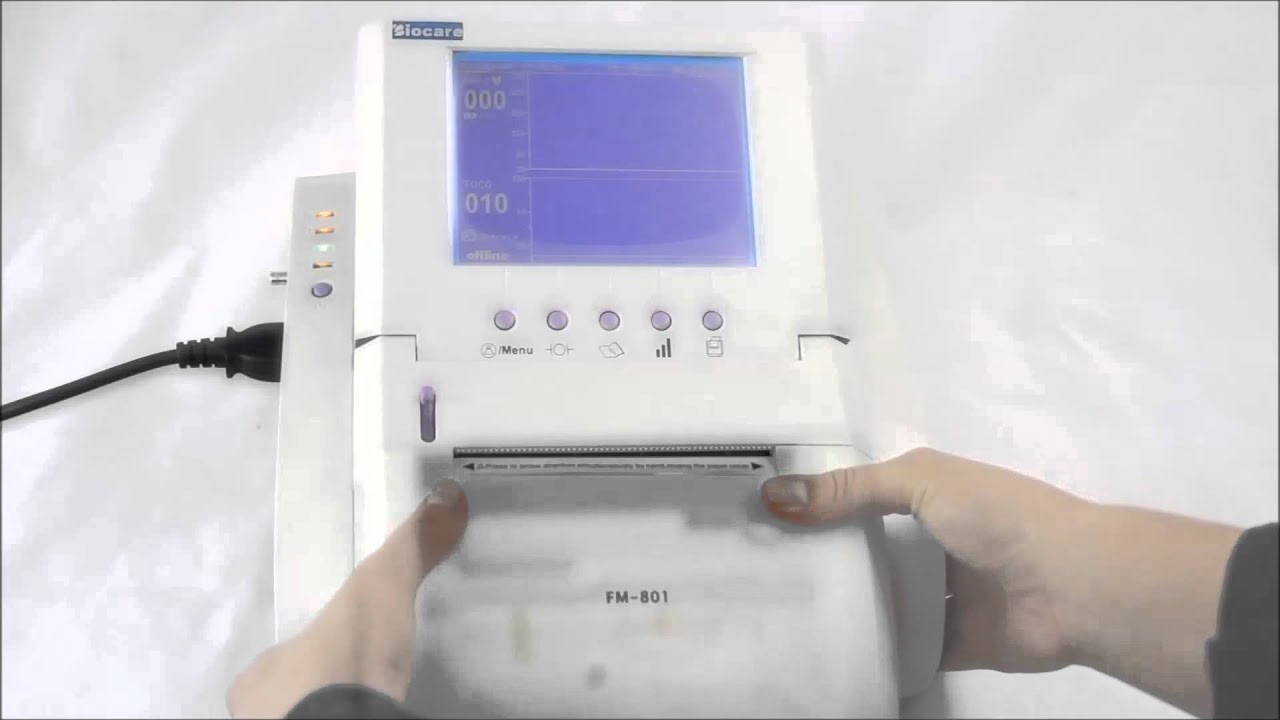 Monitor fetal biocare pm801 - YouTube