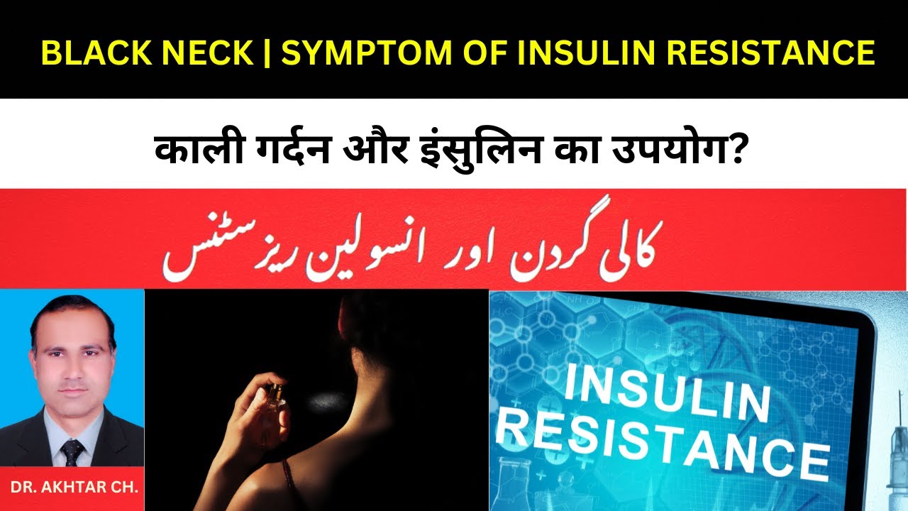 Black neck symptom of insulin resistance| کالی گردن اور انسولین ریزسٹنس ...