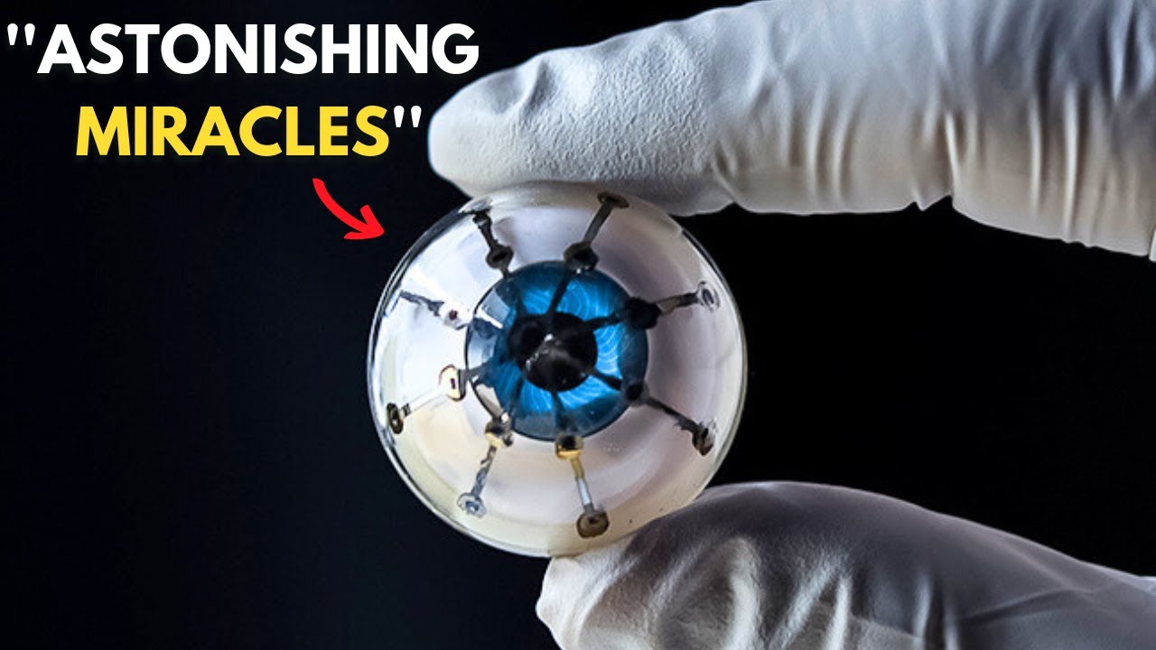 Scientists Achieve Shocking Breakthrough with Bionic Eye - YouTube