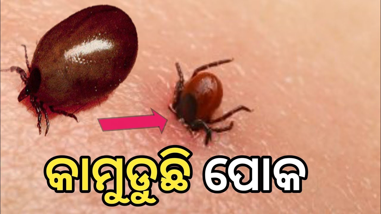 Outrage Of Scrub Typhus Disease In Odisha | Chigger Bites |@otvodisha ...