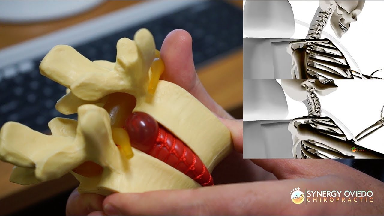 What Happens to your Spine in a Rear End Auto Accident - YouTube