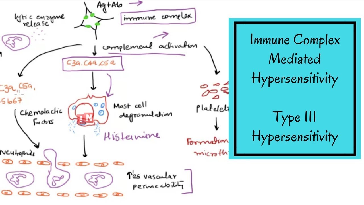 Type III Hypersensitivity – Immune Complex Mediated Hypersensitivity ...