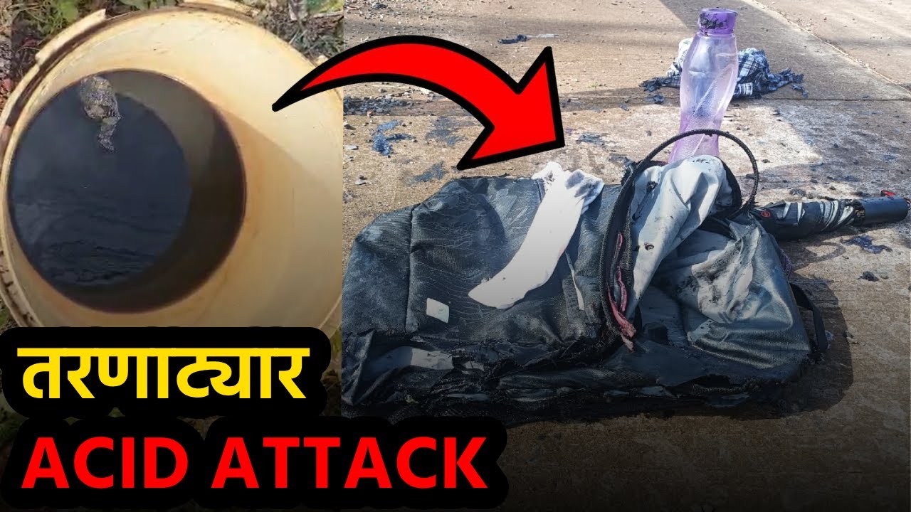 Acid Horror in Goa: Teen Boy Suffers 90% Burns in Ruthless Attack ...