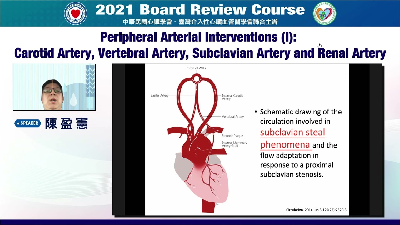 Peripheral intervention - YouTube