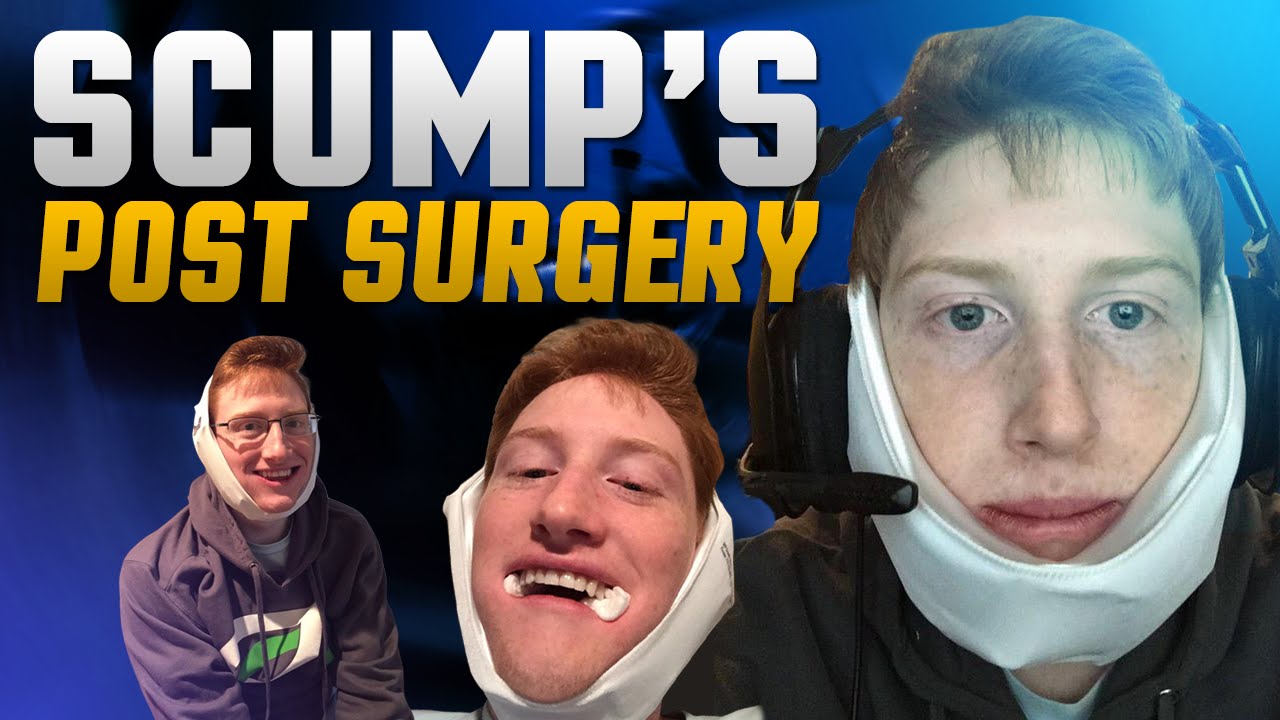 Scump's Post Surgery - YouTube