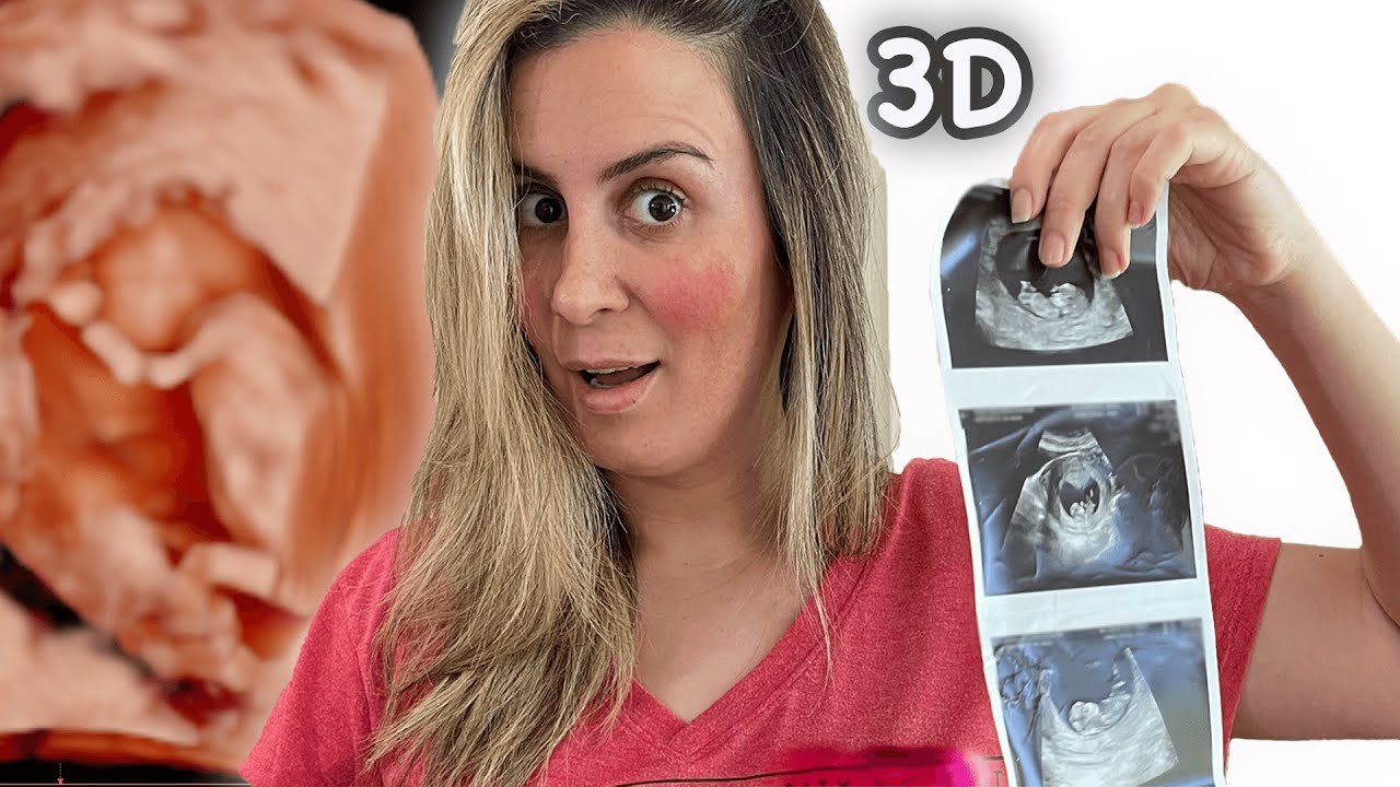 Week 10-14 Pregnancy Update & 3D Baby Ultrasound | Vlog - YouTube