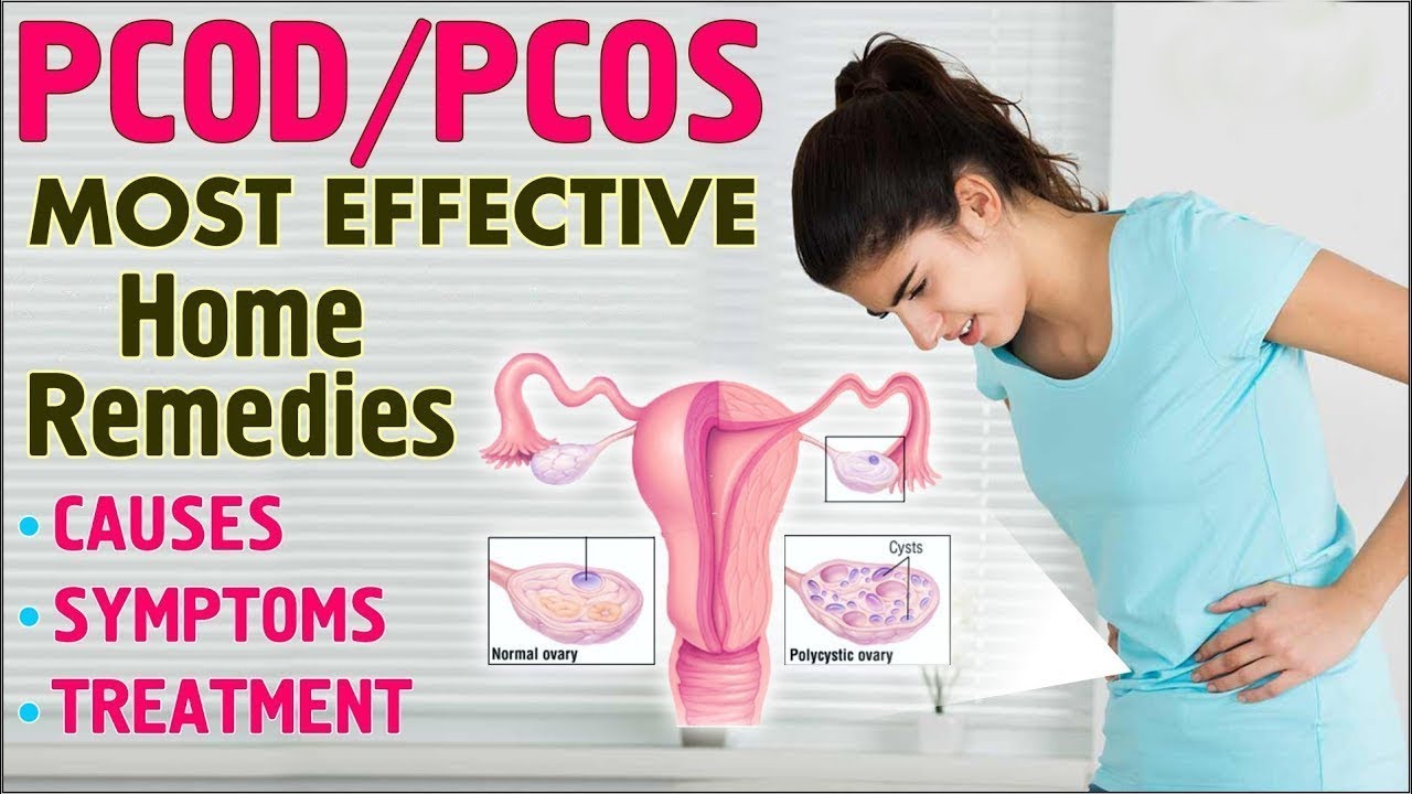 Natural Treatment For PCOS | Effective Home Remedies PCOS | Women ...