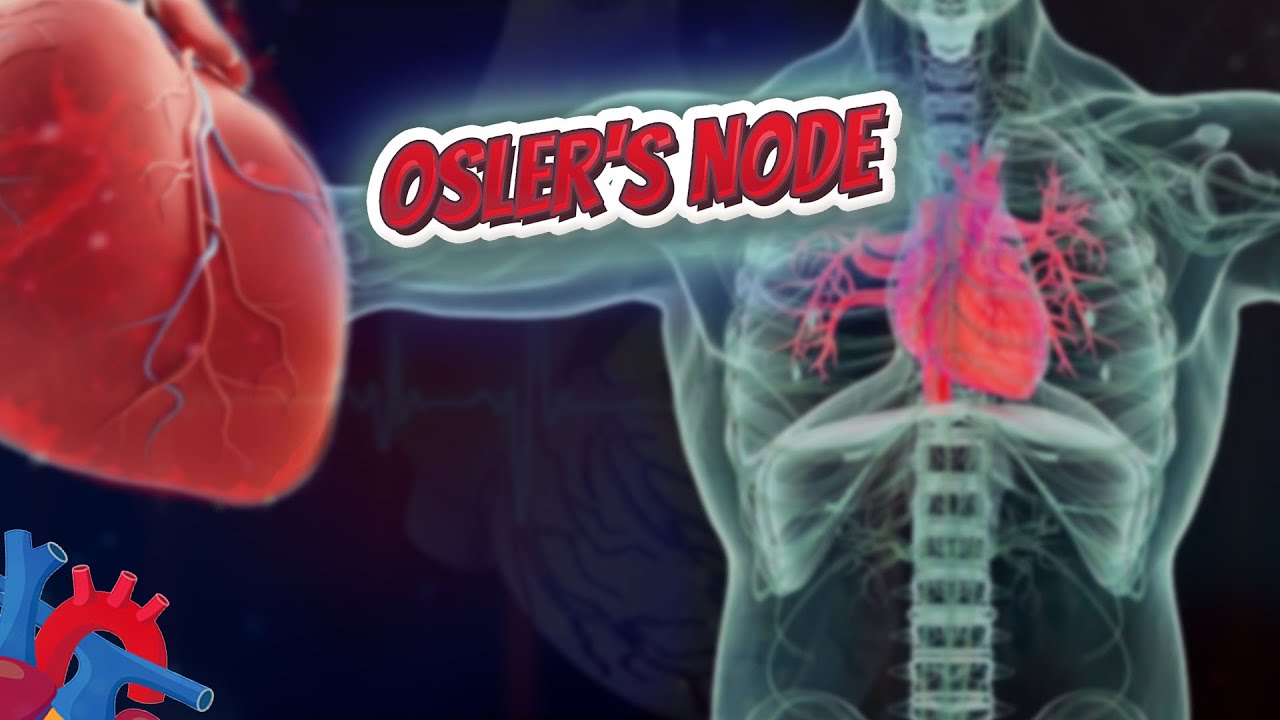 Osler's node - Human Heart and Cardiology ️ ️ ️🔊 - YouTube
