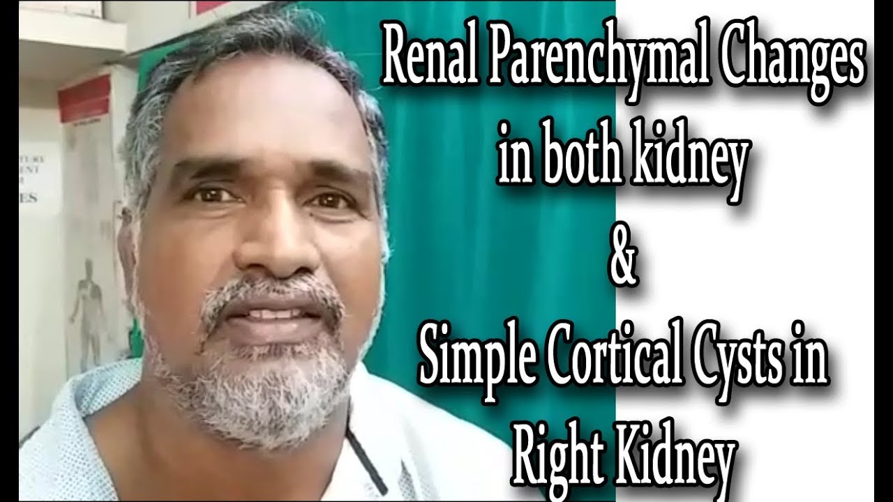 Renal Parenchymal Changes In Both kidney & Simple Cortical Cysts In ...