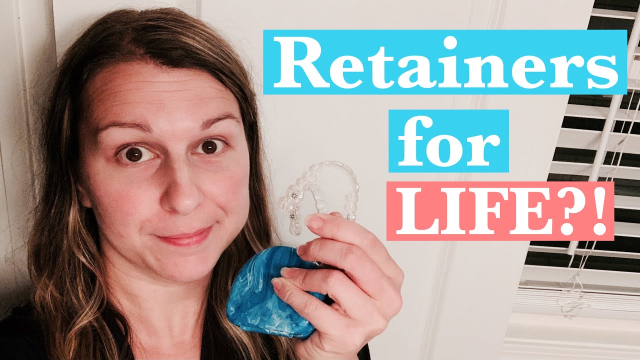 Retainers for LIFE?! - YouTube