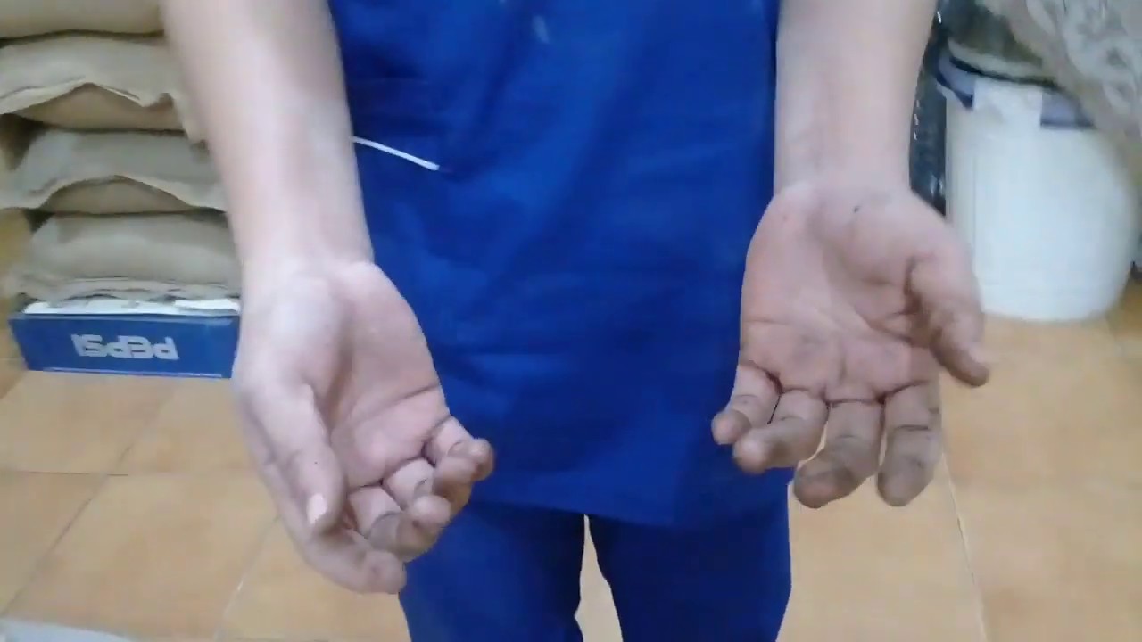 KAPOY NA KAAYO PERO ABANTE GIHAPON. NANANOM MEG MGA BULAK SA OTOT-OTOT ...